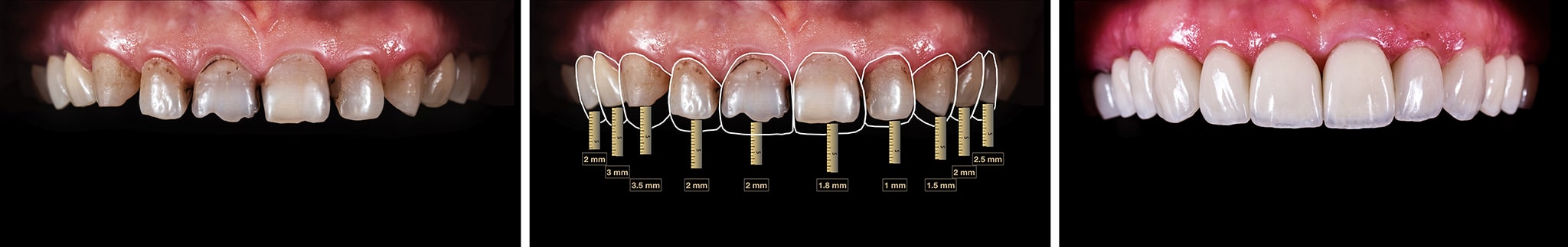 Digital Dentistry Expertise - Dental Labs - Desktop Labs